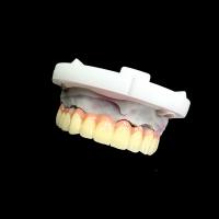 China Zirconia Porcelain Dental Crown CAD/CAM Precision Natural-Looking Aesthetic Finish ISO13485 Certified for sale