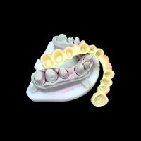 China Zirconia Porcelain Dental Crown CAD/CAM Precision Natural-Looking Aesthetic Finish ISO13485 Certified for sale