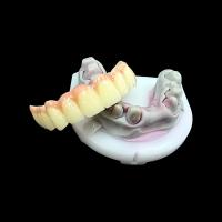 China Zirconia Porcelain Dental Crown CAD/CAM Precision Natural-Looking Aesthetic Finish ISO13485 Certified for sale