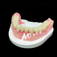 China Zirconia Porcelain Dental Crown CAD/CAM Precision Natural-Looking Aesthetic Finish ISO13485 Certified for sale