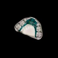 China Adjustable Expander Orthodontic Appliances Custom Made Removable Devices Providing and Comfortable Teeth Alignment Solutions for sale
