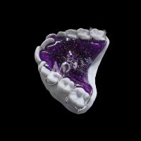China Adjustable Expander Orthodontic Appliances Custom Made Removable Devices Providing and Comfortable Teeth Alignment Solutions for sale