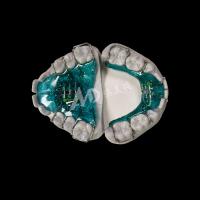 China Adjustable Expander Orthodontic Appliances Custom Made Removable Devices Providing and Comfortable Teeth Alignment Solutions for sale