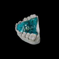 China Adjustable Expander Orthodontic Appliances Custom Made Removable Devices Providing and Comfortable Teeth Alignment Solutions for sale