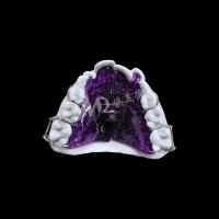 China Adjustable Expander Orthodontic Appliances Custom Made Removable Devices Providing and Comfortable Teeth Alignment Solutions for sale