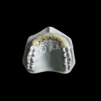 China Full Contour Monolithic Zirconia Dental Crown for sale