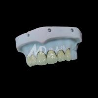 China Full Contour Monolithic Zirconia Dental Crown for sale