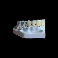 China Full Contour Monolithic Zirconia Dental Crown for sale