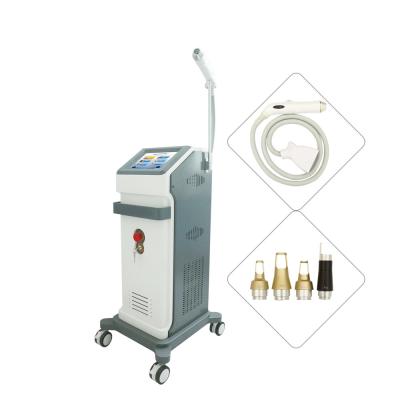 China Q Switched Nd Yag Laser 532nm 1000W Skin Treatment for Hyperpigmentation Tattoo Removal for sale