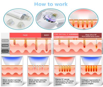 China 15 Inch TFT Diode Laser Hair Removal Machine 20 Million Shots 1600W for sale