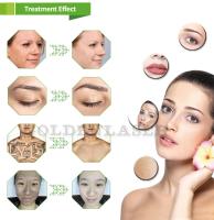 China 808nm Diode Laser Hair Removal Machine 1600W Standing Type for Professional Use for sale
