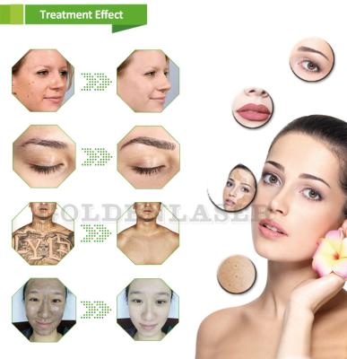 China 808nm Diode Laser Hair Removal Machine 1600W Standing Type for Professional Use for sale