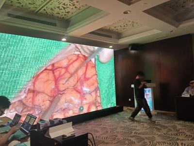 China Zero Strobe Polarized 3D Screen Low Crosstalk Medical Teaching Display Device for sale