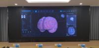 China Custom Polarized 3D Screen High Performance Medical 3D Visualization Equipment for sale