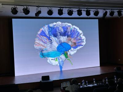 China High-refresh-rate polarized 3D display for medical conference research for sale