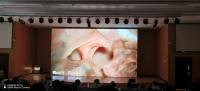 China High-refresh-rate polarized 3D display for medical conference research for sale