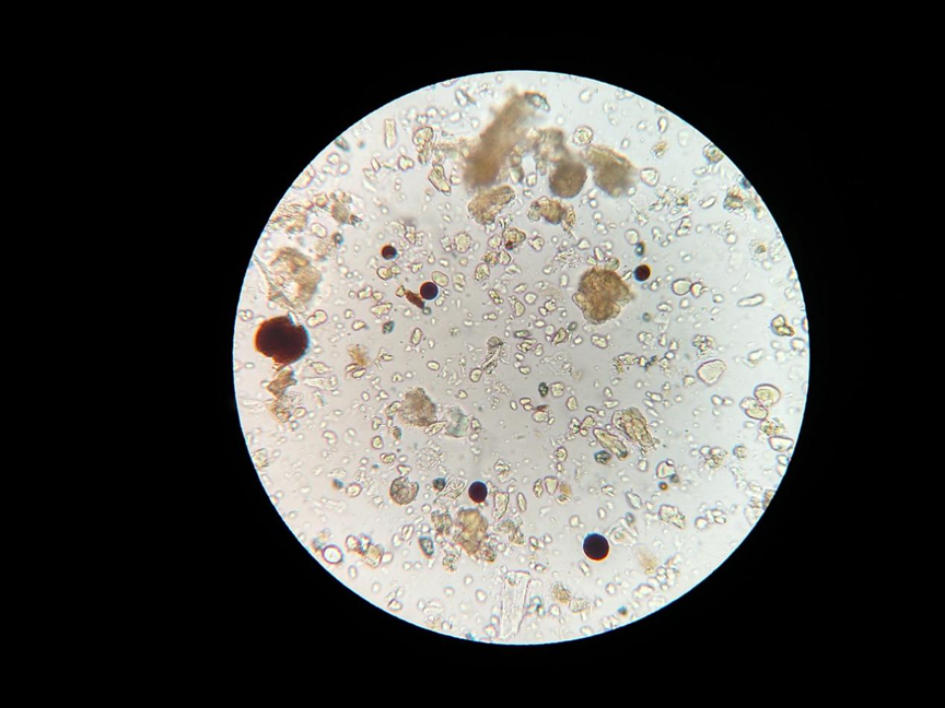 Microbial activity chart