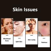 China Compact Skin Led Facial Light Therapy for Acne Improvement Professional Grade for sale