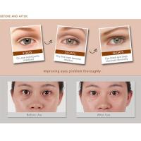 China Effortlessly Firm Skin with Vibrating Eye Rolling Ball Massager Pen NO Waterproof for sale