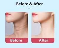 China Rated Power 2.5W LED Therapy Neck Rejuvenation V-Face Lifting Massager for Anti-Aging for sale