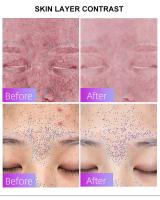China High Energy Led Smart Facial Skincare and Mask Therapy Light Red Pdt Rejuvenation ABS for sale