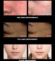 China Face Target Area Thinner 40*29.5cm Silicone LED Facial Mask with High Energy 2024 for sale