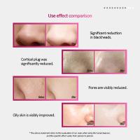 China Inductive Charging Facial Cleanser Waterproof Vibration Pink Black Gift Box 160*95*54 for sale