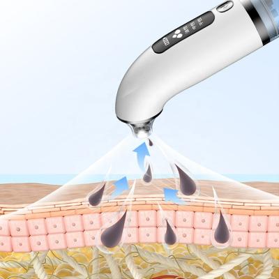 China 3 Gears Oxygen Injection Appliance for Effective Pore Cleansing and Blackhead Removal for sale