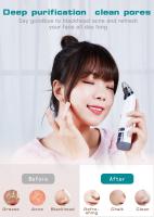 China 2023 Facial Blackhead Remover with USB Charge Plugs Type and Ultrasonic Skin Scrubber for sale