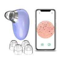 China Facial Cleaner Blackhead Removal Tool with Camera Wi-Fi Mini Visible Vacuum in 2023 for sale