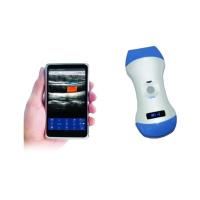 China Portable Ultrasound Scanner with Color Doppler Technology - Medical Diagnostic Imaging Equipment for Carotid and Cardiac Applications for sale