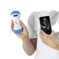 China Portable Ultrasound Scanner with Color Doppler Technology - Medical Diagnostic Imaging Equipment for Carotid and Cardiac Applications for sale