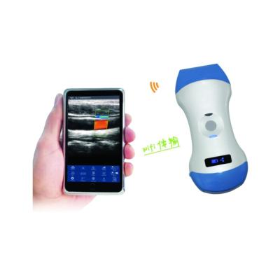 China Wireless Handheld Doppler Ultrasound Scanner with Color Doppler Imaging for Carotid Artery and Cardiac Applications for sale