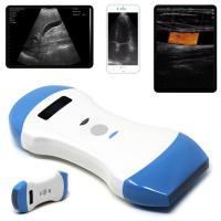 China Wireless Handheld Doppler Ultrasound Scanner with Color Doppler Imaging for Carotid Artery and Cardiac Applications for sale