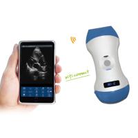 China Wireless Handheld Doppler Ultrasound Scanner with Color Doppler Imaging for Carotid Artery and Cardiac Applications for sale