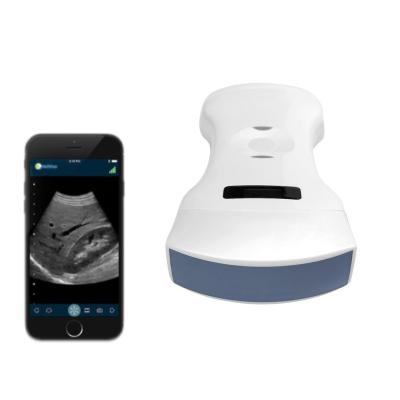 China Hearty Expression HE-BUS06 Handheld Ultrasound Scanner with 2-10MHz Dual Probe and WiFi Connectivity for sale