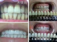 China Hearty Expression HE-CLYT01 Dental Whitening Instrument with 460-490nm Blue LED Cold Light and 1250mm Adjustable Arm for sale