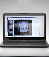 China RVG Digital Pattern Dental X-Ray System Portable High Frequency 60KV 7800mAh Battery HEDXRT01 for sale