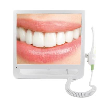 China Digital X-Ray Sensors Dental Intra Oral Camera with 1280x1024 Resolution and 10MP Sensor - USB Interface Medical Device for sale