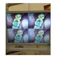 China Intra Oral Dental Camera with 10 Million Pixel Sensor, 17-inch Display and 10 LED Lights for Medical Imaging for sale