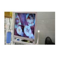 China Intra Oral Dental Camera with 10 Million Pixel Sensor, 17-inch Display and 10 LED Lights for Medical Imaging for sale