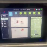 China Walnut Kernel Sorting Machine AI-Powered Industrial-Grade Stability Real-Time Monitoring For Intelligent Nut Processing for sale