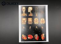 China 0.15mm Medical Radiation Printing Film for sale