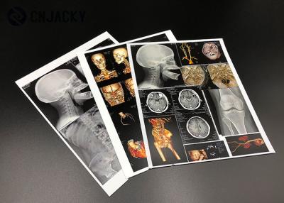 China 0.15mm Medical Radiation Printing Film for sale