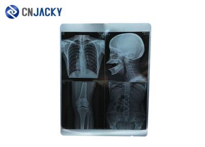 China 100 Sheet / Pack X Ray 44m Medical Radiation Printing Film for sale