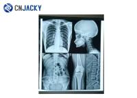 China Hospital Examination CT 14 