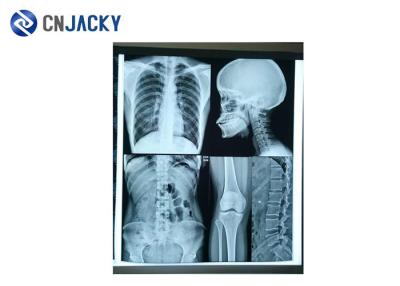 China Hospital Examination CT 14 