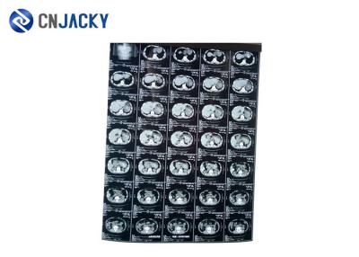 China 195 Micron Dental X Ray Film for sale