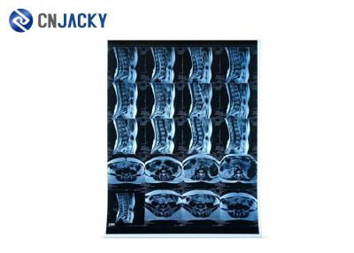 China 150 Micron A4 Size 0.15mm Blue X Ray Film for sale
