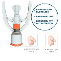 China ODM ZSR Disposable Circumcision Stapler for Anorectal Urology Surgery for sale